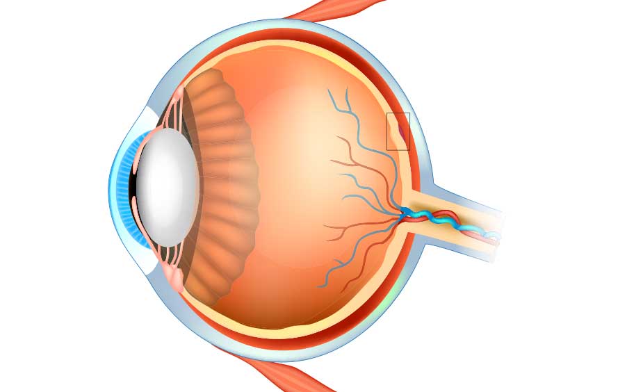 Retina and Vitreous Treatment & Surgery | Retina Center of Vermont