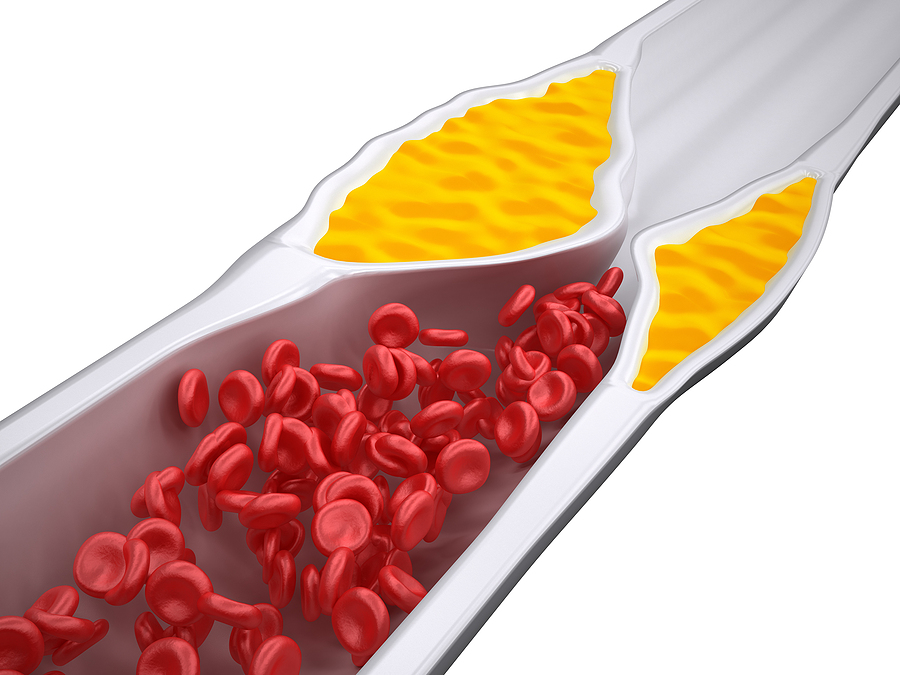 CT Scan | Vermont Diagnostic Imaging